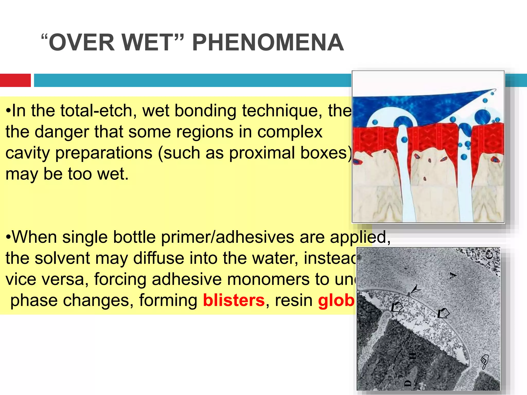 DENTIN BONDING AGENTS | PPTX