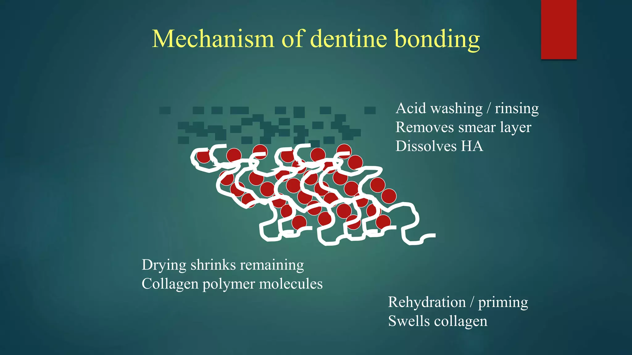 dentin bonding agents | PPTX