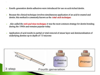 Dentin bonding agents sneha | PPTX