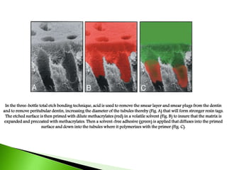 Dentin bonding agents sneha | PPTX