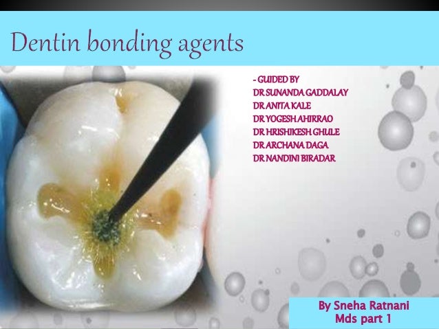 Dentin bonding agents sneha