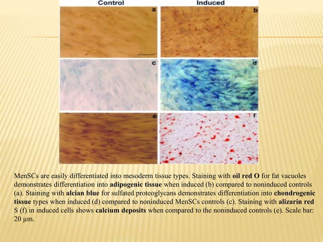 Menstrual Blood stem cells | PPTX | Reproductive Health | Diseases and ...