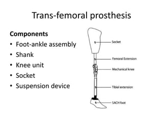 prosthetics | PPTX