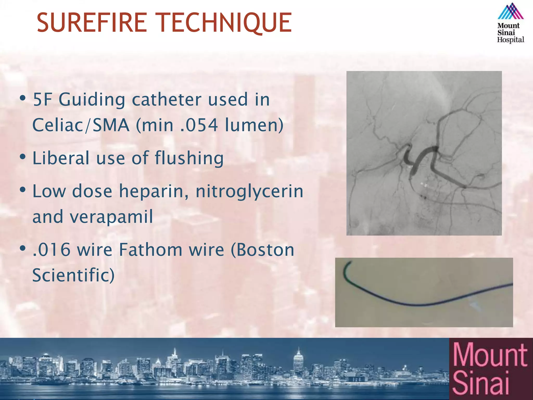 Biederman DM - AIMRADIAL 2014 Endovascular - Surefire catheter | PPTX