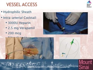 Biederman DM - AIMRADIAL 2014 Endovascular - Surefire catheter | PPTX