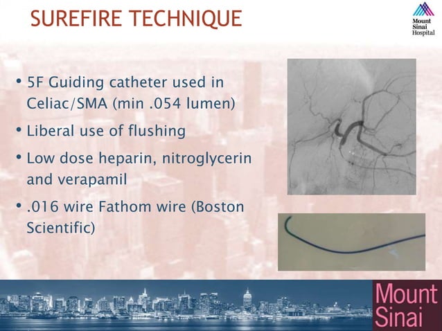 Biederman DM - AIMRADIAL 2014 Endovascular - Surefire catheter | PPT