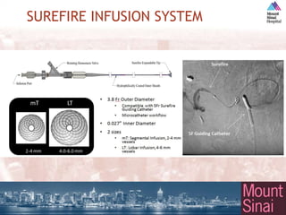 Biederman DM - AIMRADIAL 2014 Endovascular - Surefire catheter | PPTX