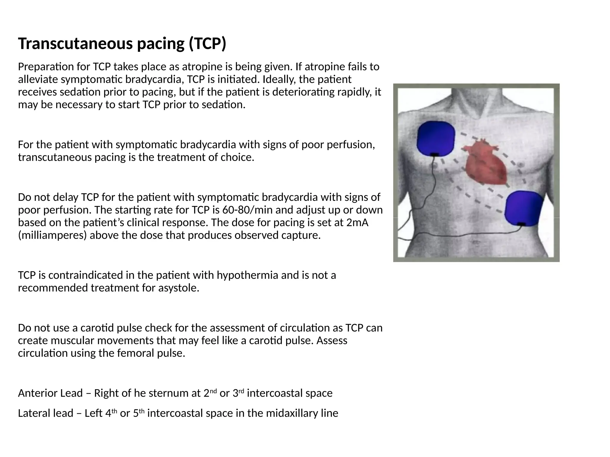 BRADYCARDIA presentation for bls acls.pptx