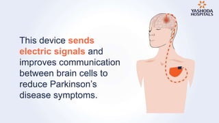 Deep Brain Stimulation for Parkinson's disease | Treatment at Yashoda ...