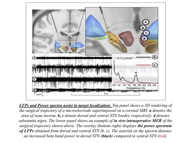 DBS Advances.pptx