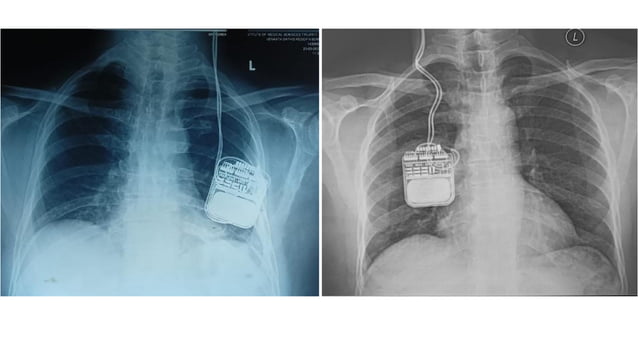 DBS ppt extra slides - Copy for presentation | PPTX