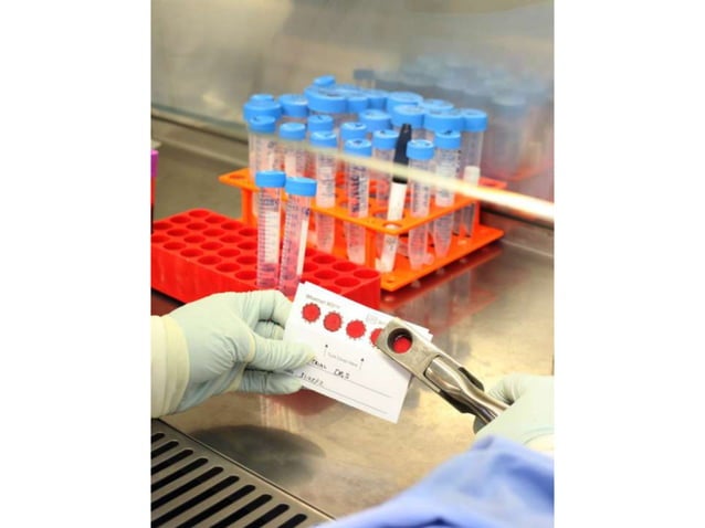 Dried blood spot HIV testing | PPTX | Infectious Diseases | Diseases ...