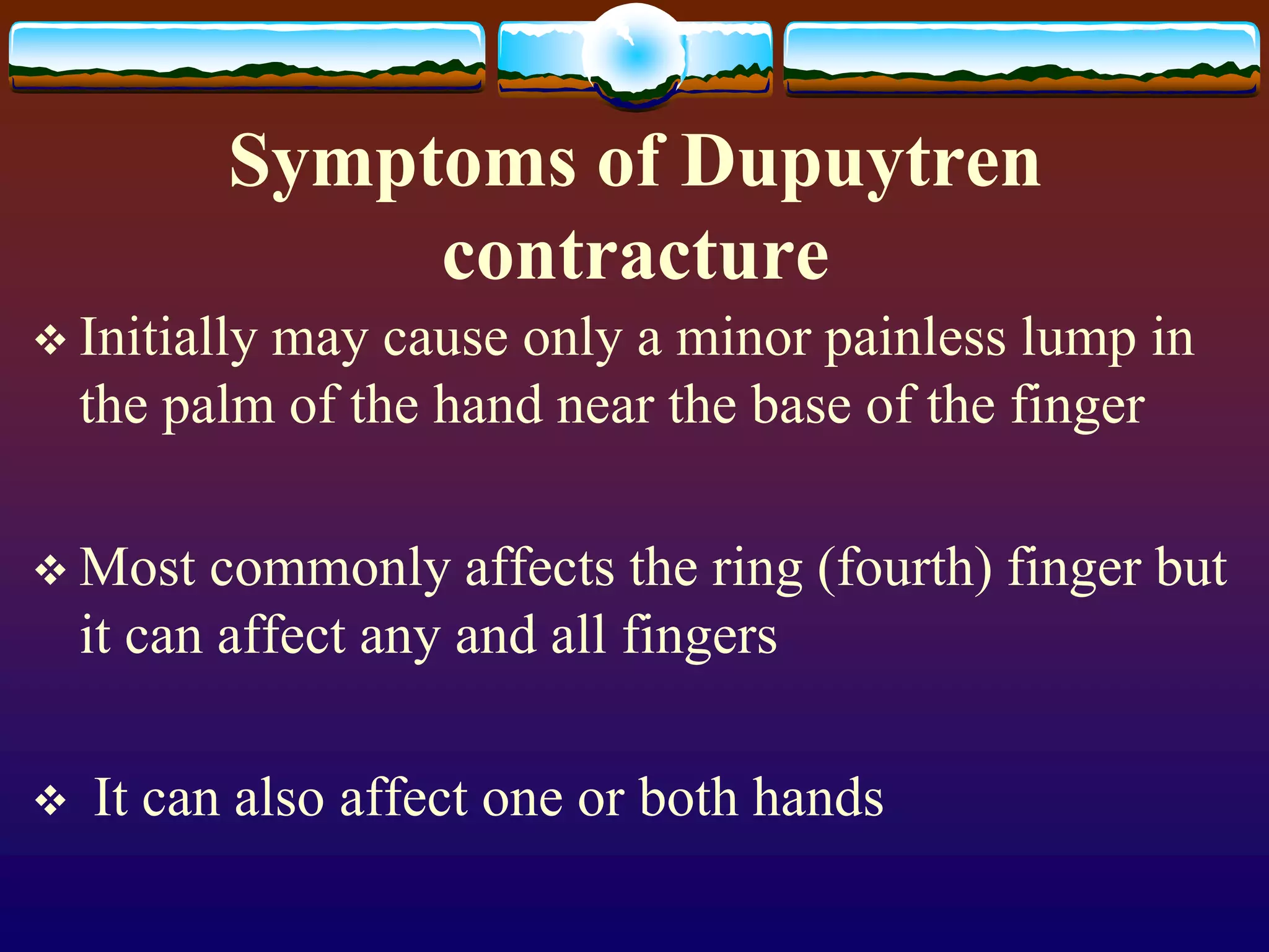 Dupuytren's Contracture | PPT