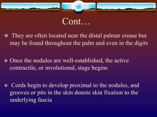 Dupuytren's Contracture | PPT