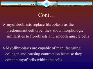 Dupuytren's Contracture | PPT