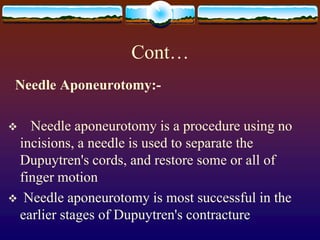 Dupuytren's Contracture | PPT