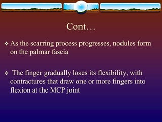 Dupuytren's Contracture | PPT