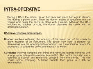 Dilatation and curettage (D & C) | PPTX