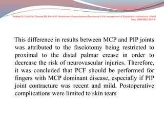 Dupuytren's Contracture By Ansarul Haq | PPTX | Injuries | Diseases and ...