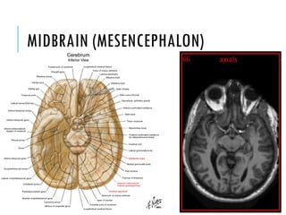 Anatomy of the Brain | PPTX