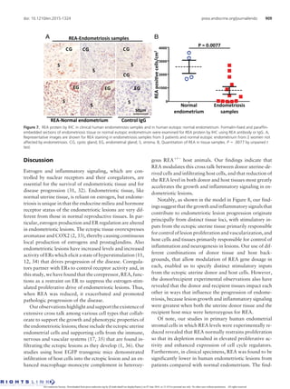 REA in Endometriosis_2015 | PDF