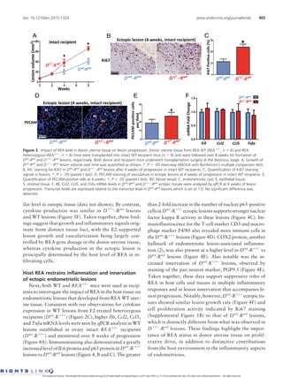 REA in Endometriosis_2015 | PDF