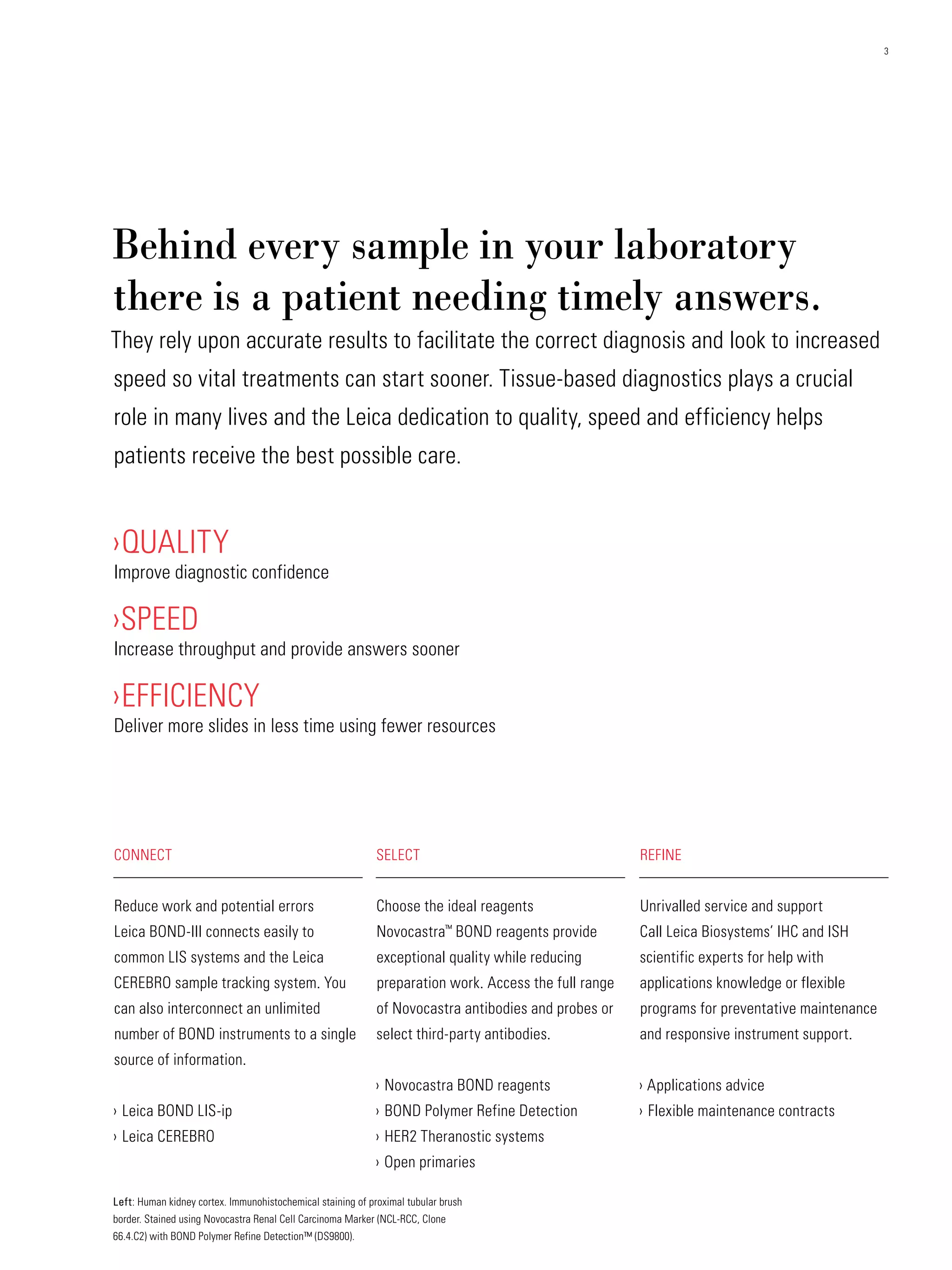 Leica_bondIII_brochure | PDF