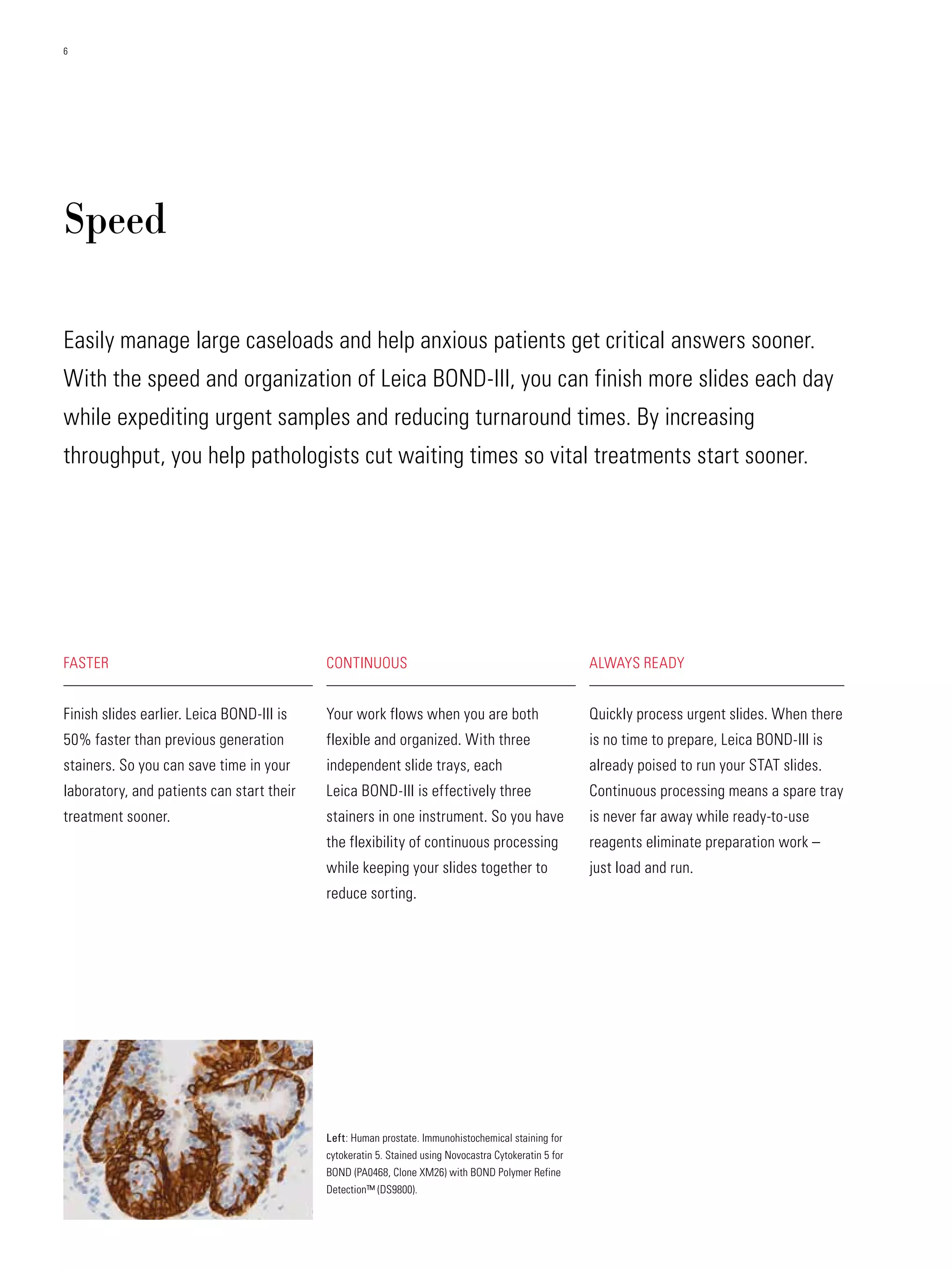 Leica_bondIII_brochure | PDF