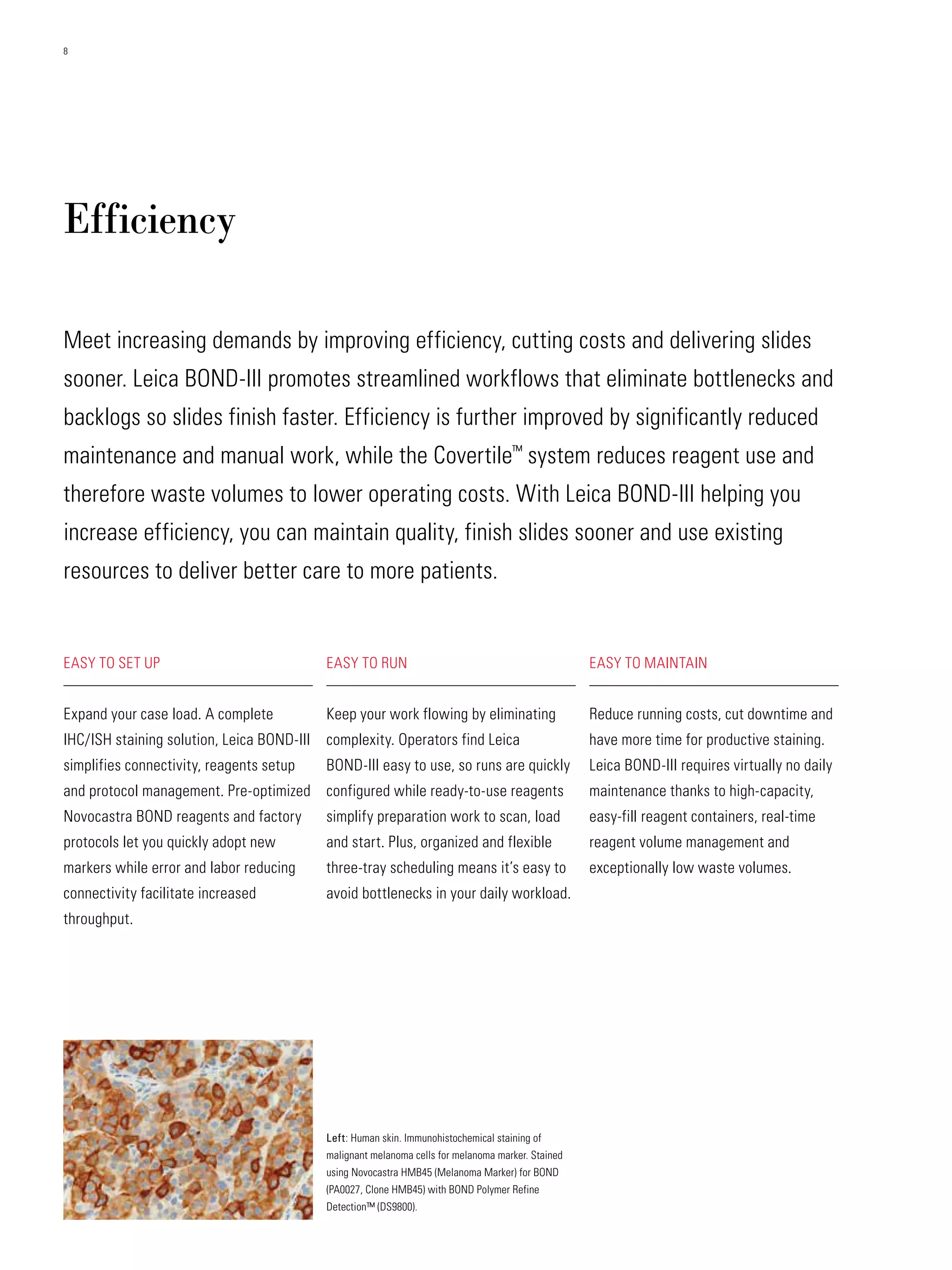 Leica_bondIII_brochure | PDF