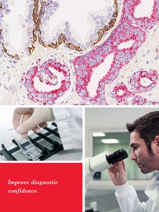 Leica_bondIII_brochure | PDF