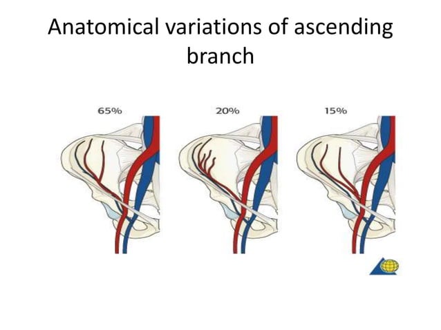 Deep circumflex iliac artery flap | PPT