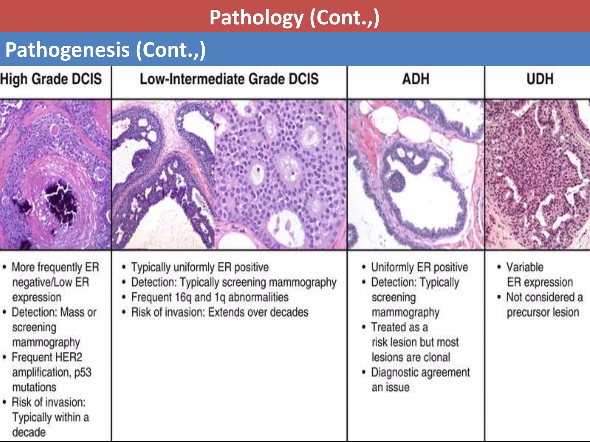 Ductal Carcinoma In Situ (DCIS) | PPTX