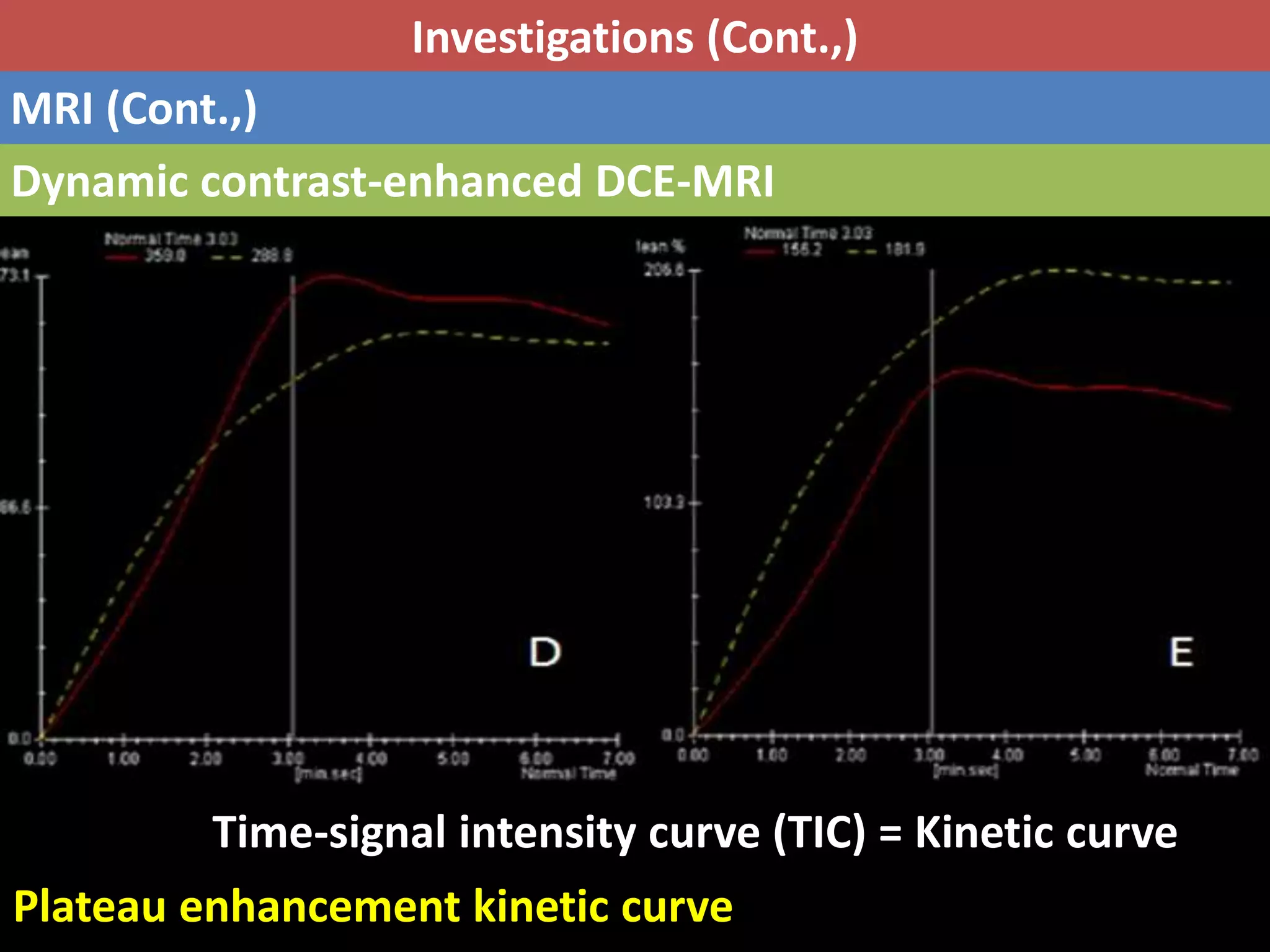 Ductal Carcinoma In Situ (DCIS) | PPTX | Cancer | Diseases and Conditions