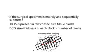 Ductal carcinoma in situ of breast - classification and management | PPT