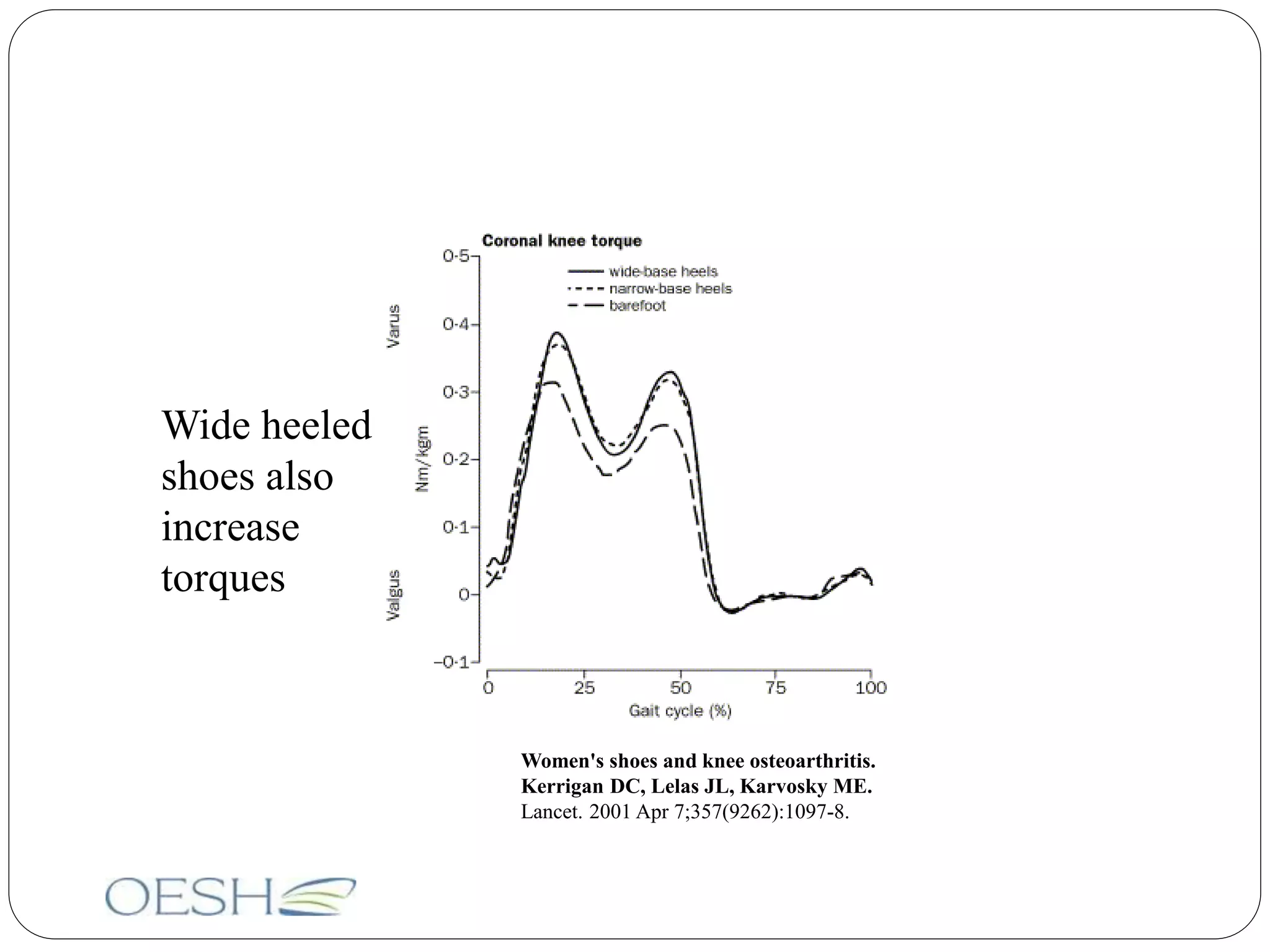 Healthy Shoe Design - How shoes affect joints | PPTX