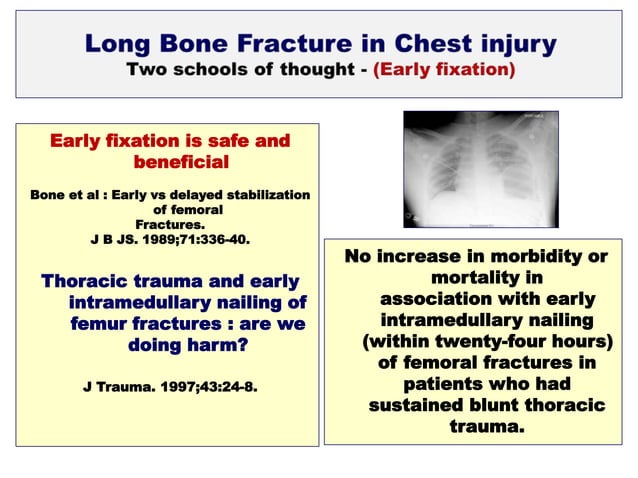 Damage Control Orthopaedics (DCO) | PPTX
