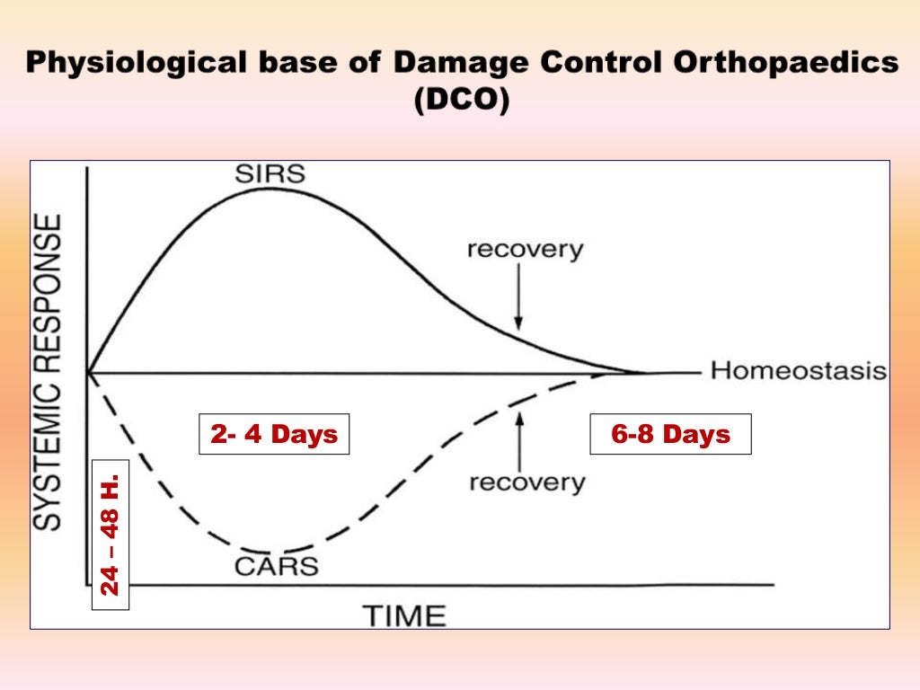 Damage Control Orthopaedics (DCO)