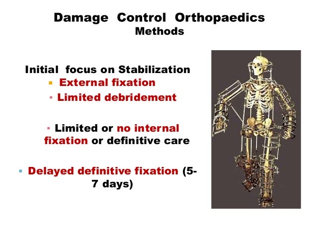 Damage Control Orthopaedics (DCO)
