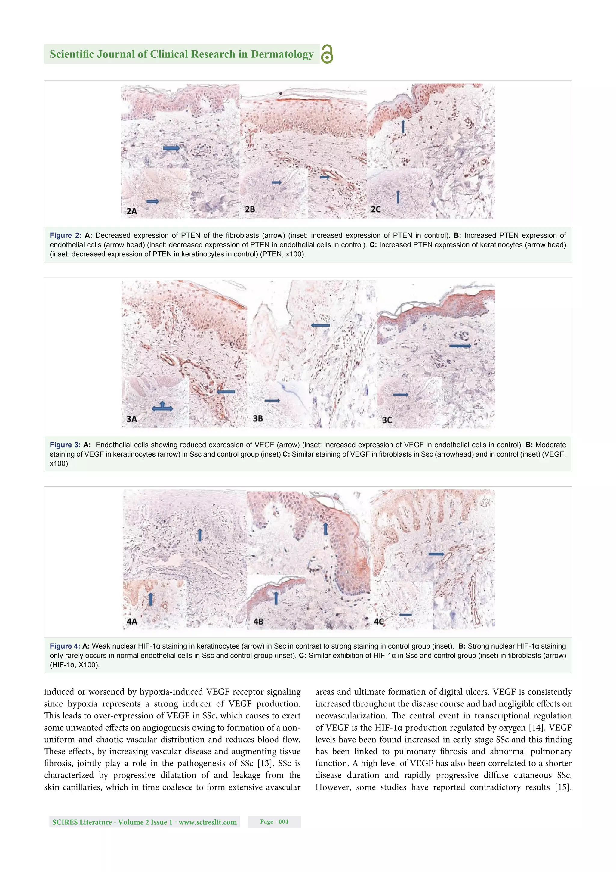 Scientifi c Journal of Clinical Research in Dermatology | PDF