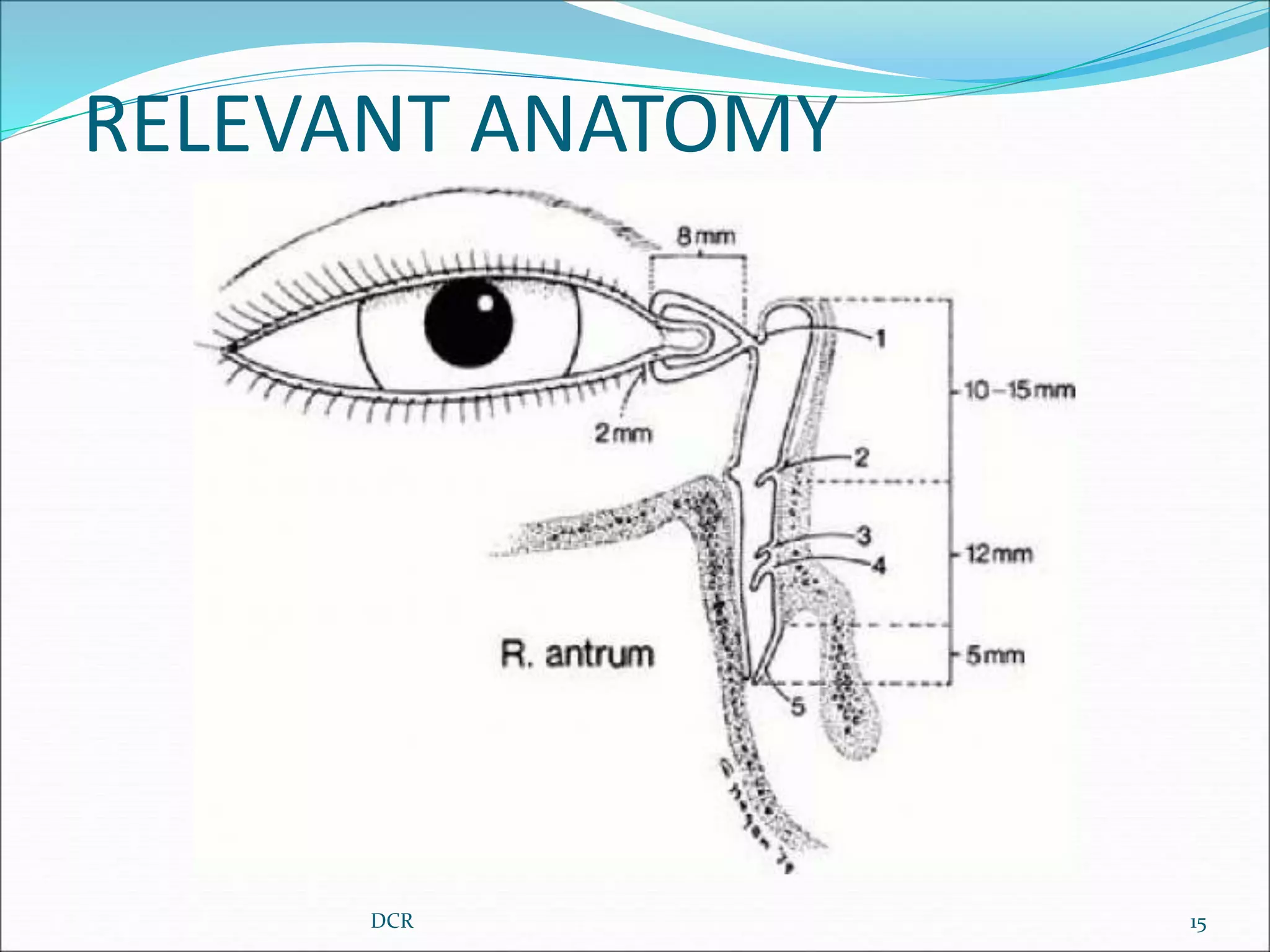 DACRYOCYSTORHINOSTOMY (DCR) - Powerpoint | PPT