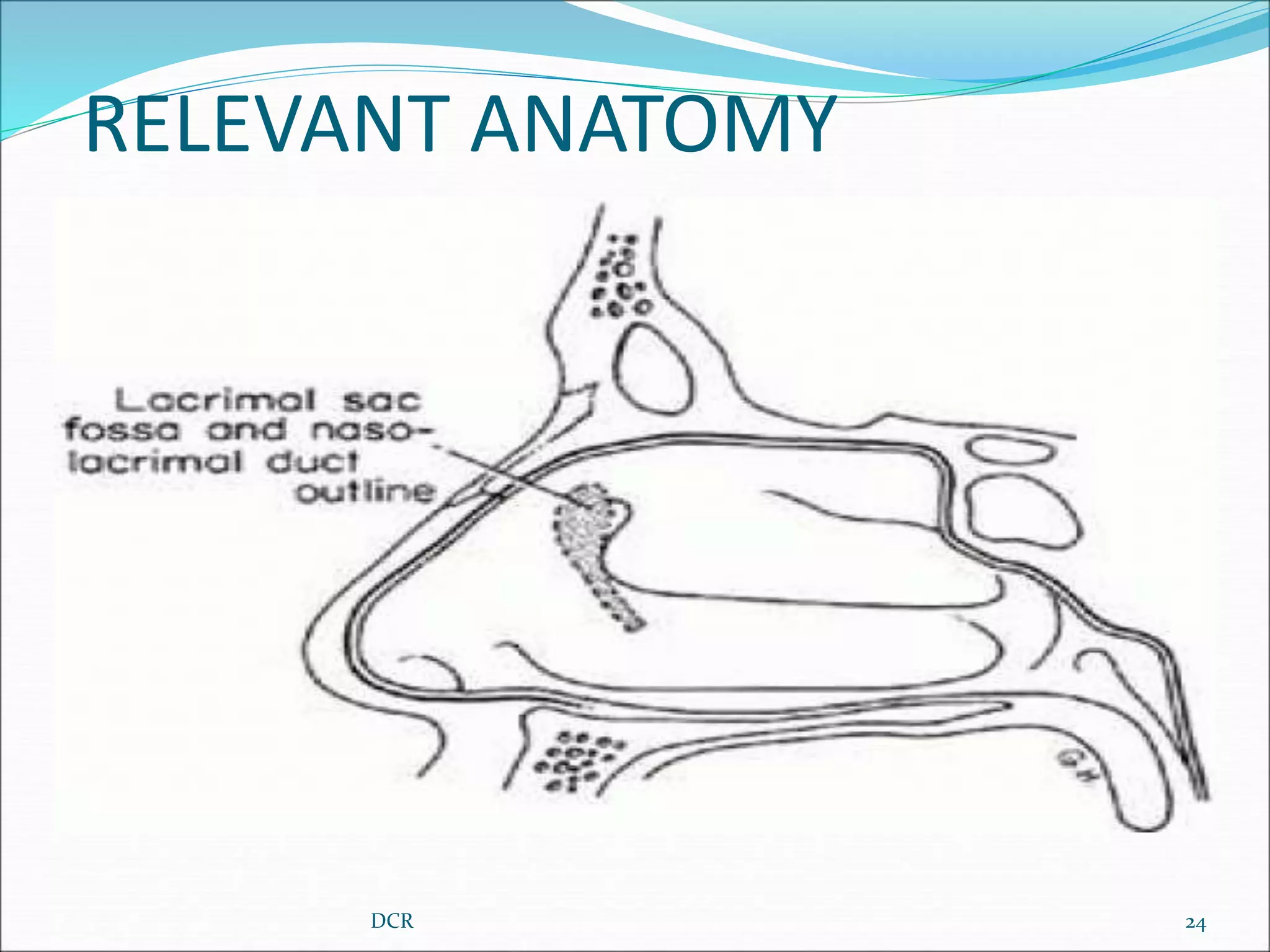 DACRYOCYSTORHINOSTOMY (DCR) - Powerpoint | PPT