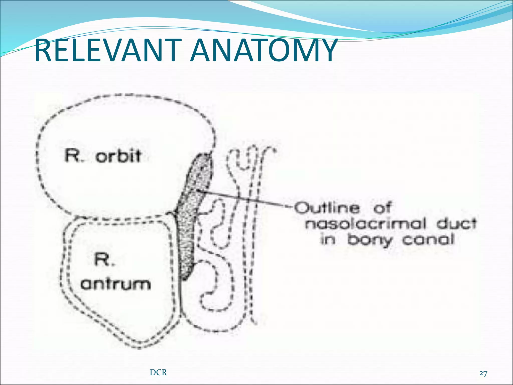 DACRYOCYSTORHINOSTOMY (DCR) - Powerpoint | PPT
