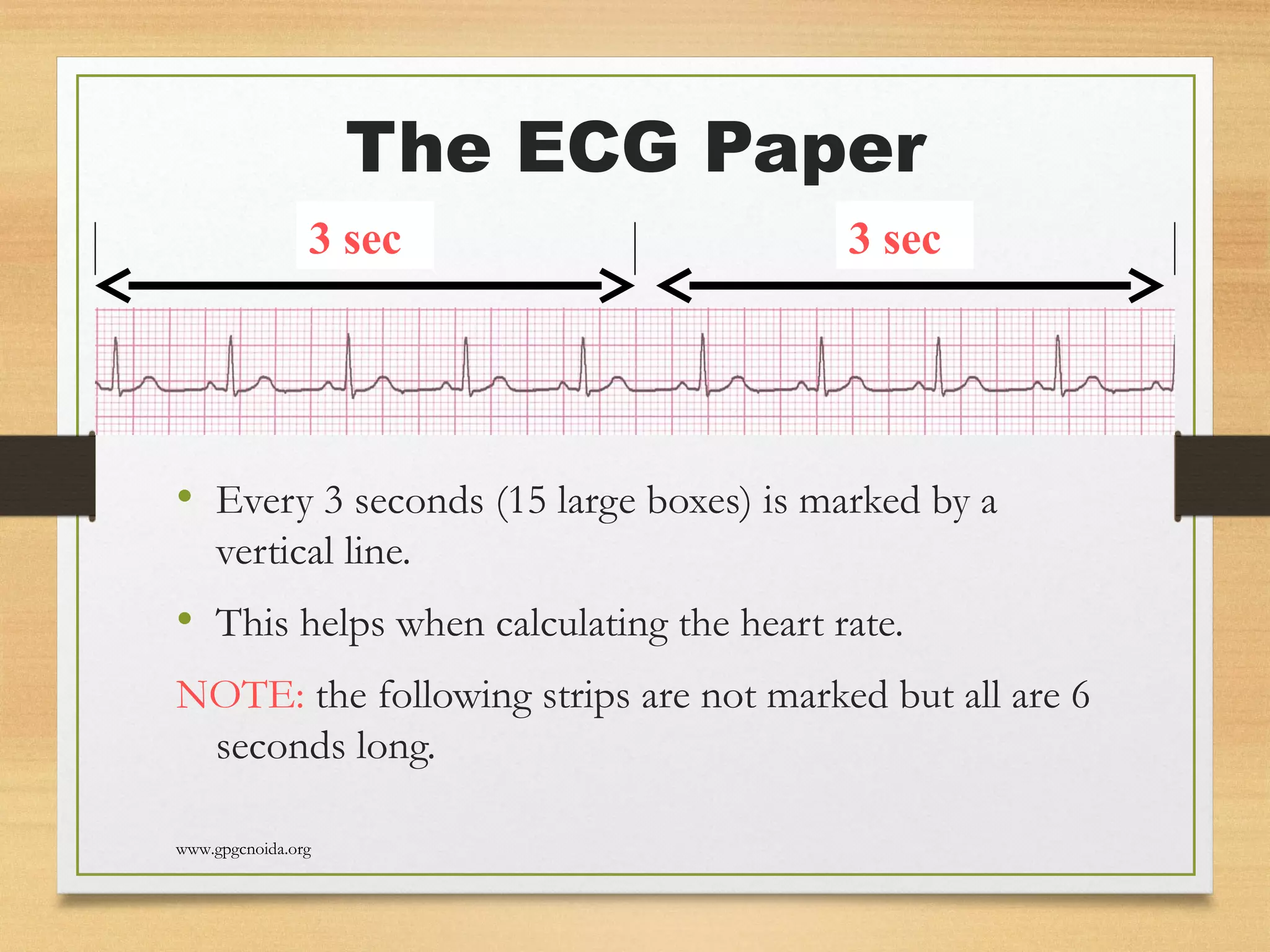 Electro Cardio Gram - Basics of ECG | PPT