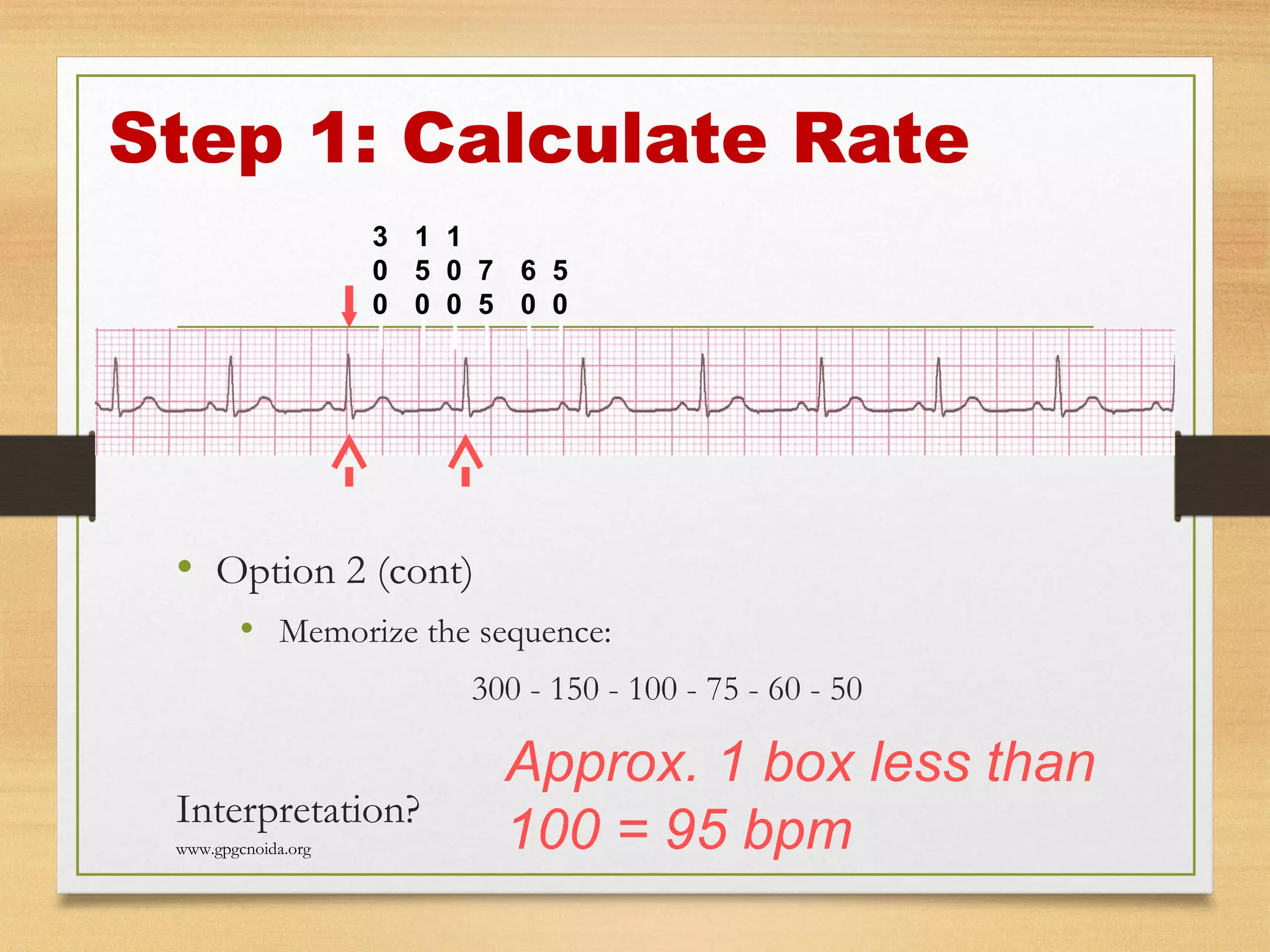 Electro Cardio Gram - Basics of ECG | PPT