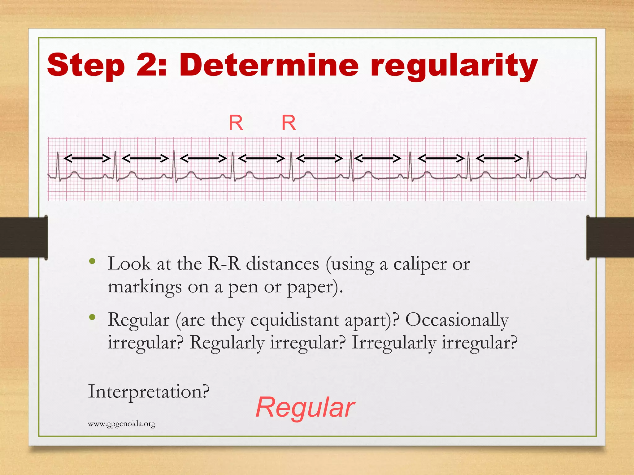 Electro Cardio Gram - Basics of ECG | PPT
