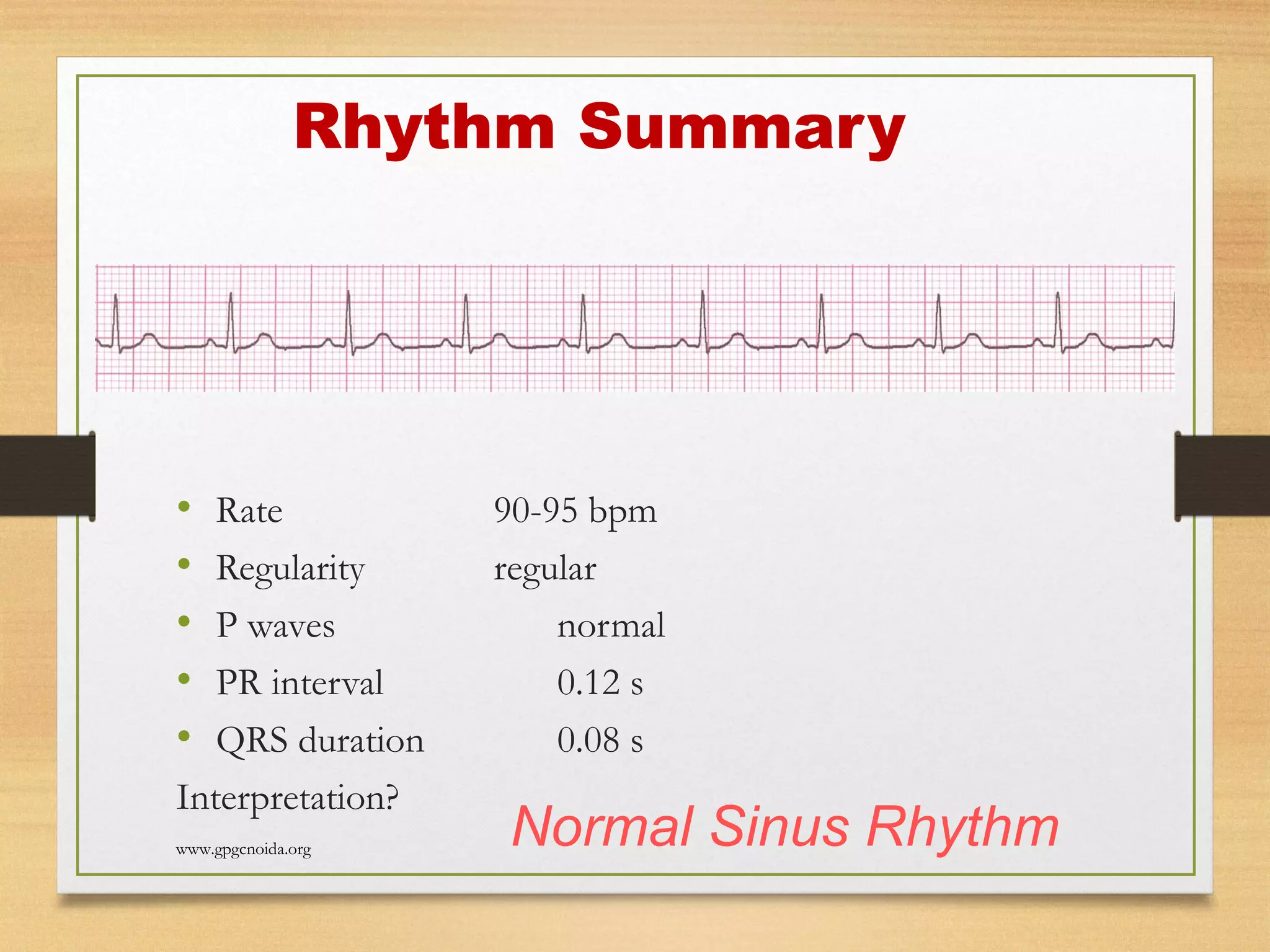 Electro Cardio Gram - Basics of ECG | PPT