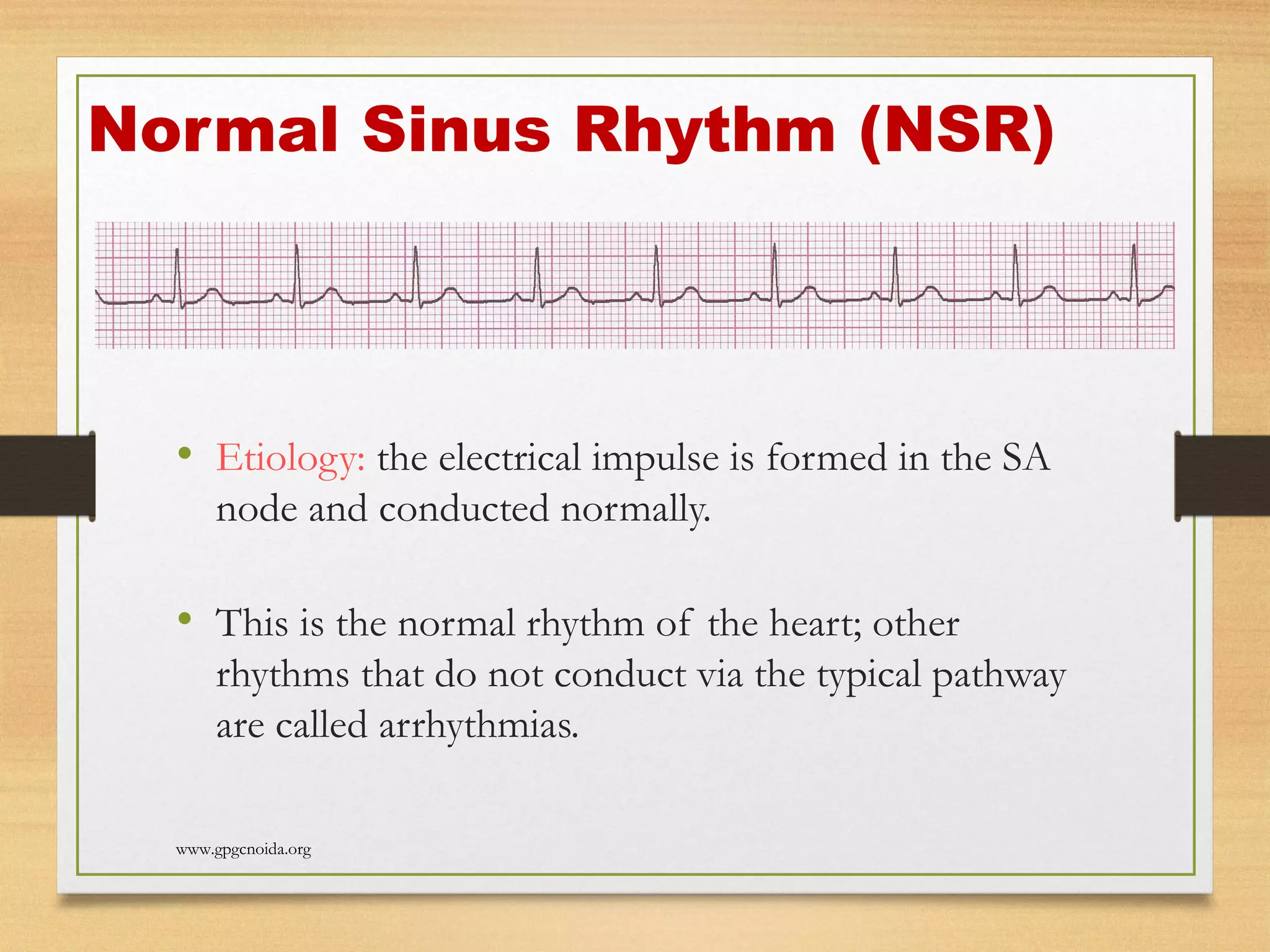 Electro Cardio Gram - Basics of ECG | PPT
