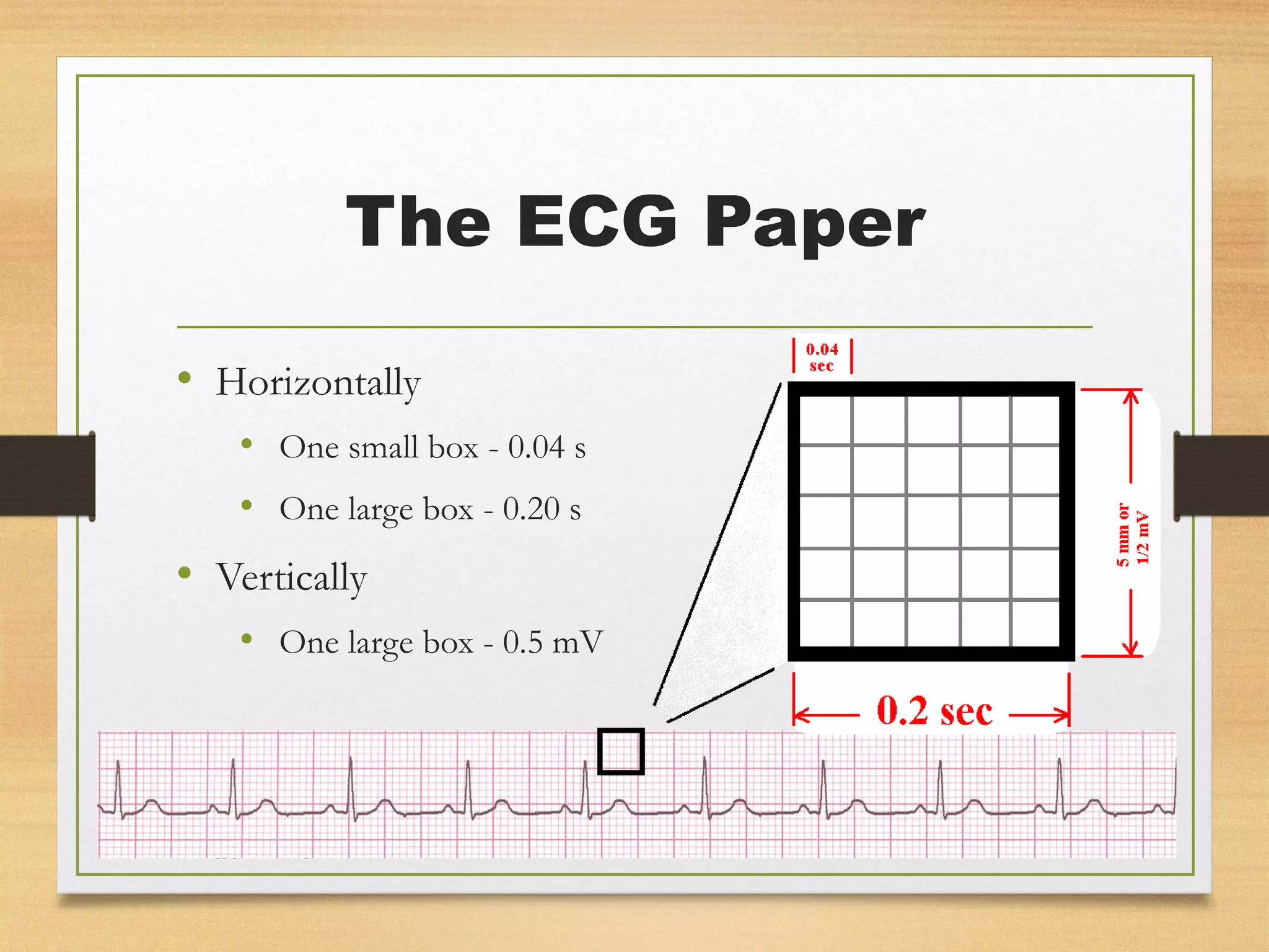 Electro Cardio Gram - Basics of ECG | PPT