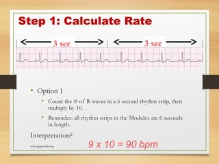Electro Cardio Gram - Basics of ECG