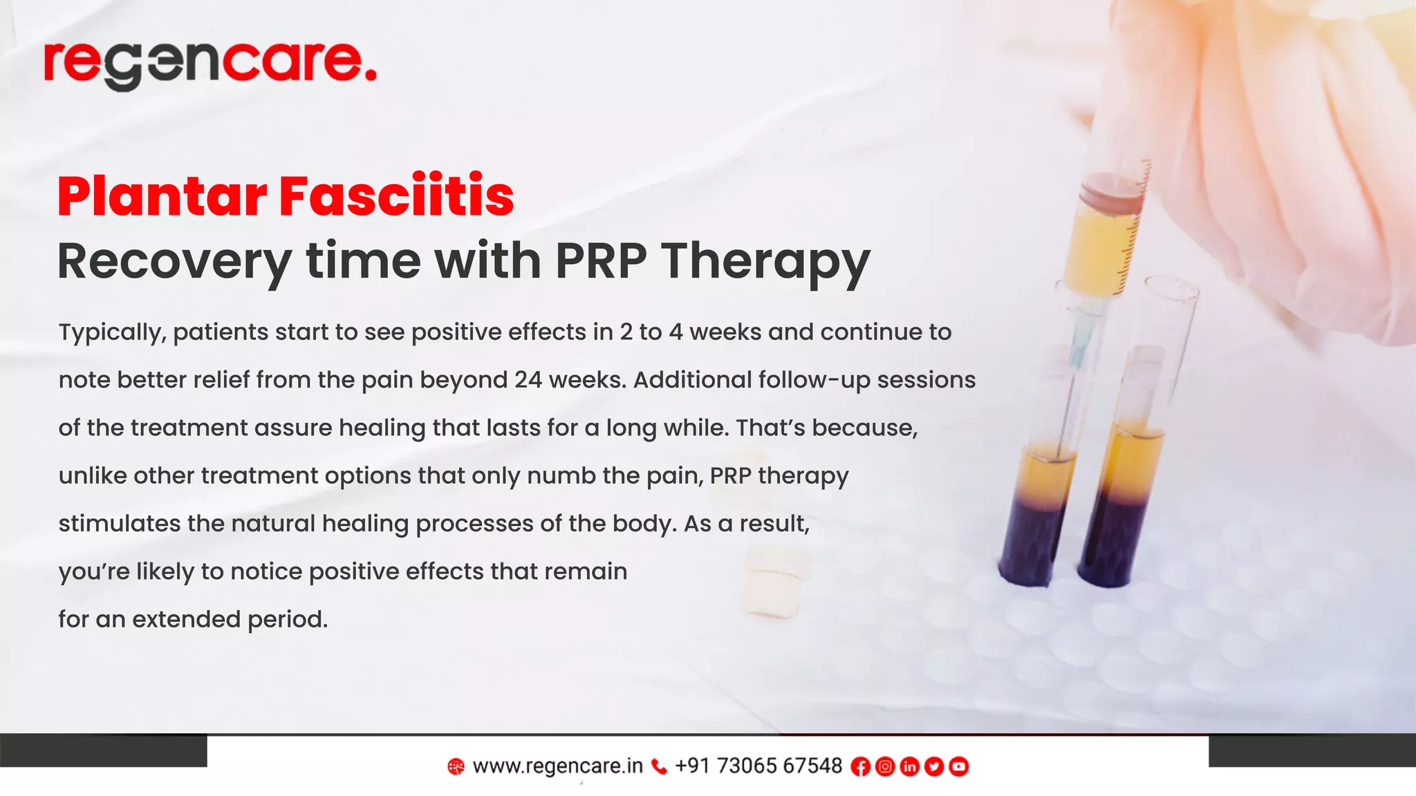 Why to Choose PRP for Plantar Fasciitis? | PDF